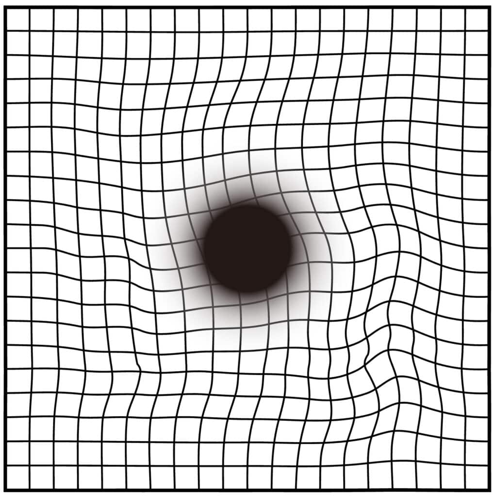 Age-related Macular Degeneration (AMD) Cannabinoids | InMed