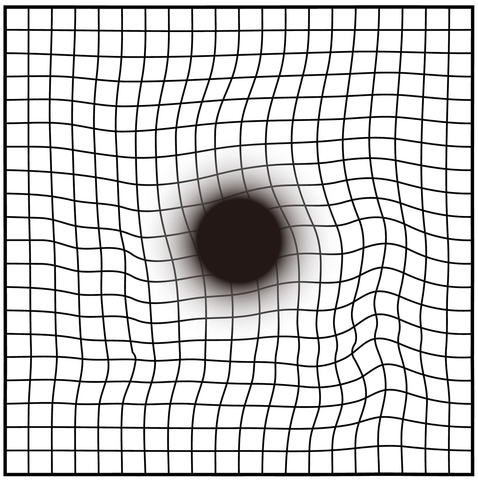 Age-related Macular Degeneration (AMD) Cannabinoids | InMed